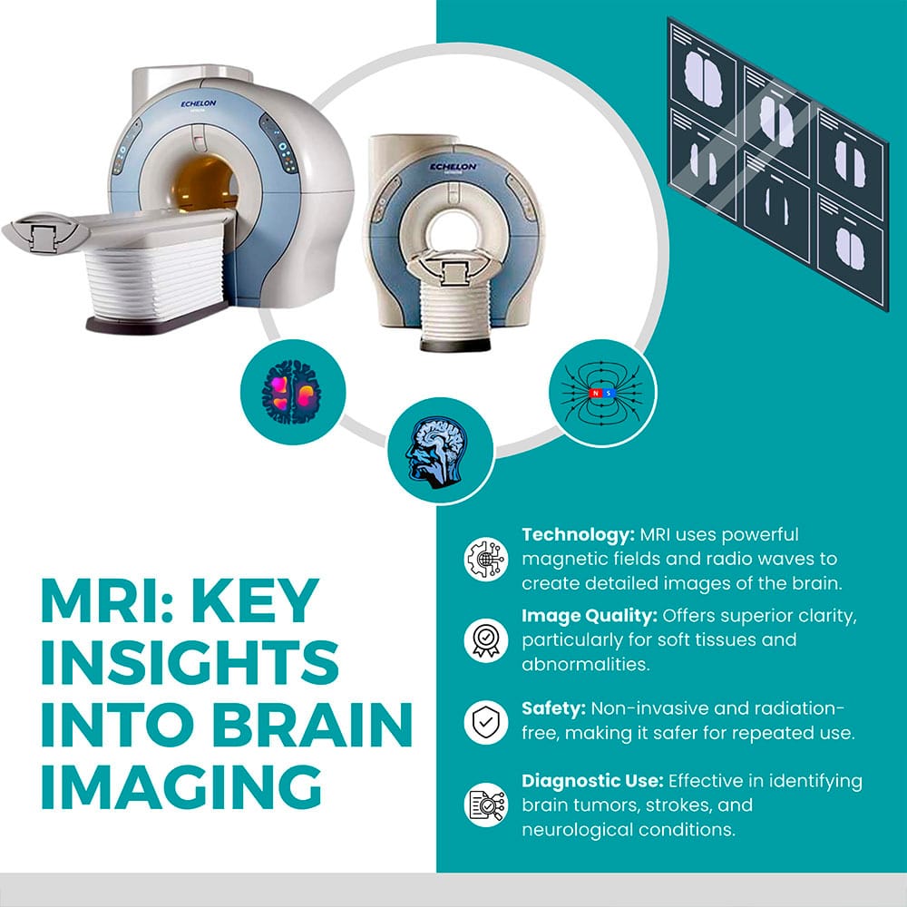 Read About Which is Better for Brain Imaging: MRI vs CT Scan
